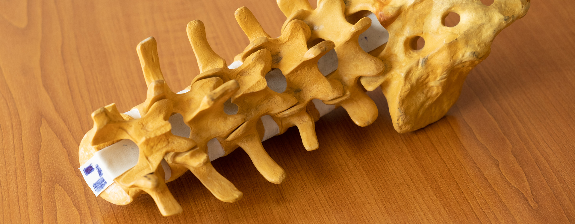 Osteoporose, Osteopenie – Orthopädie am Park